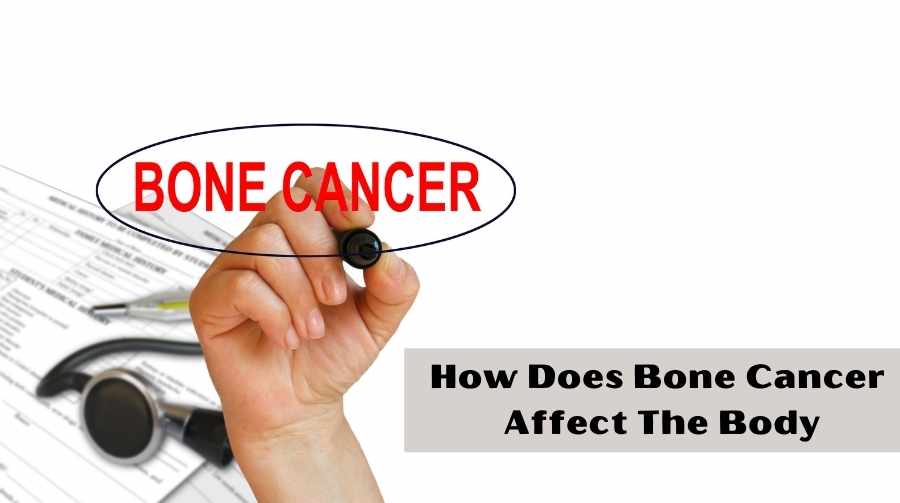 How Does Bone Cancer Affect The Body Dr Chetan Anchan How Does Bone Cancer Affect The Body Dr Chetan Anchan